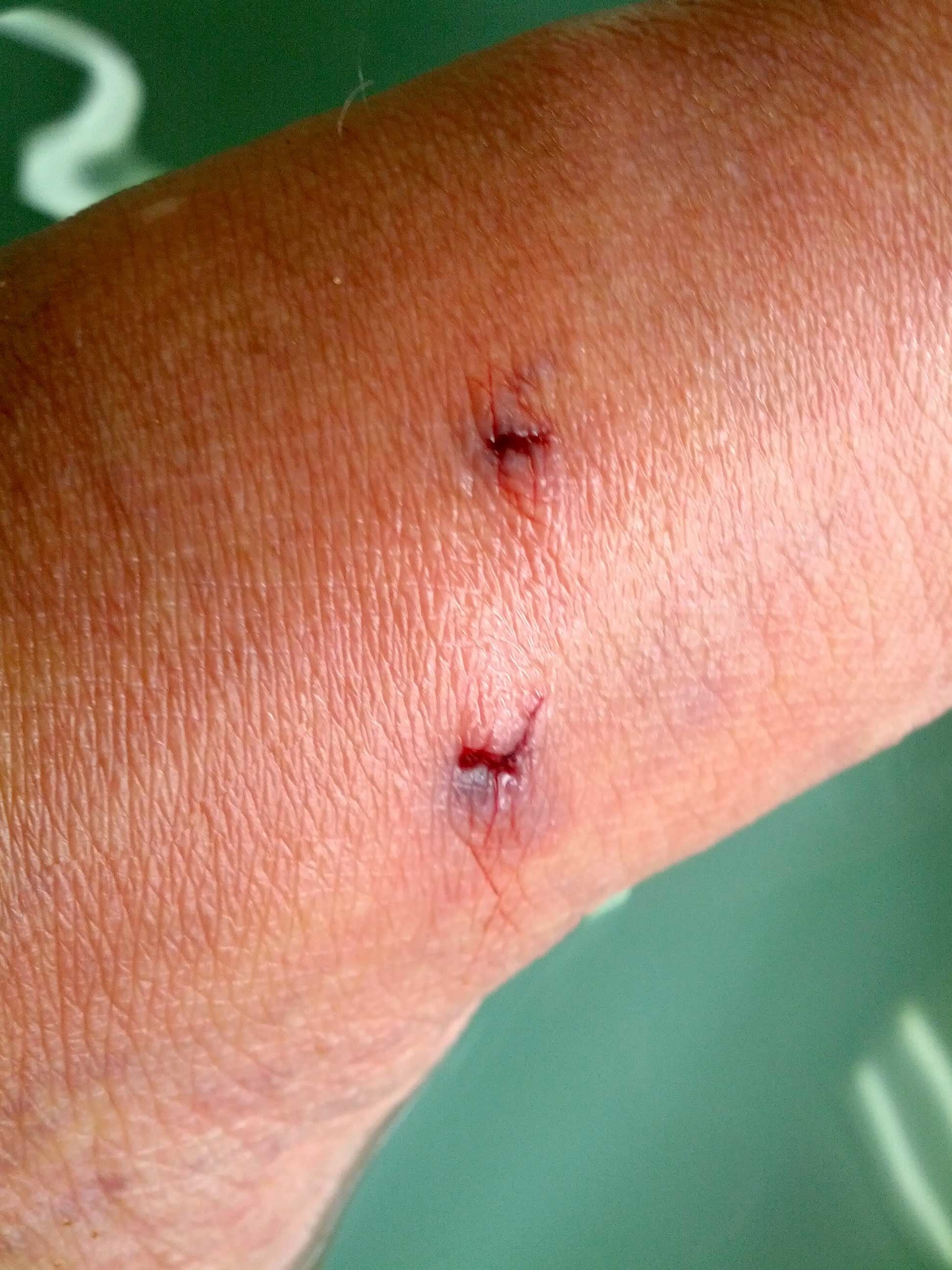 Stingray strikes in Byron – Echonetdaily