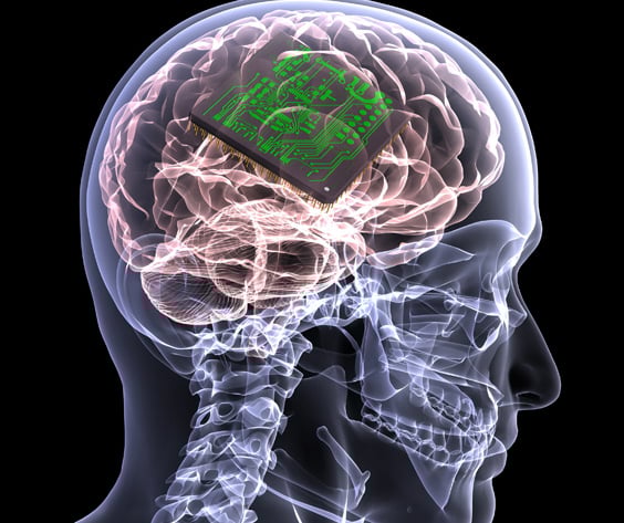 brain-implant – The Echo